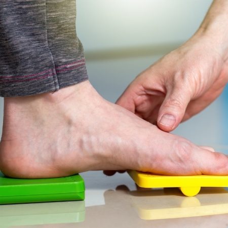 Structural Foot Deformities | Common Foot Conditions